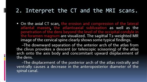 104. Basilar Invagination - YouTube