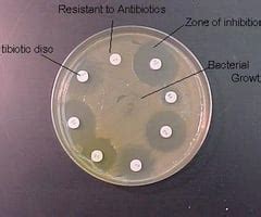 Image result for Disadvantages of Using Disk Diffusion Method