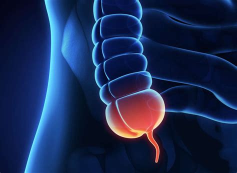 Image result for Appendix WHA Is It