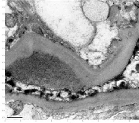 Image result for Electron Microscope Magnification