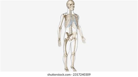 Image result for Types of Abnormal Bone Formation