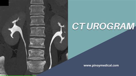 Image result for Urogram 3 Phase CT