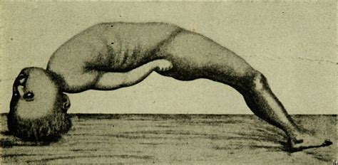 Image result for Intubation Position