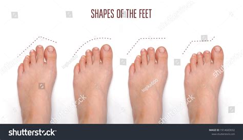 Image result for Different Types of Toes