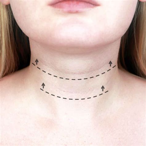 Image result for Back Neck Threading