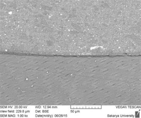 Image result for Scanning Electron Microscope Magnification