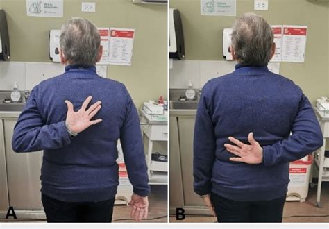 Image result for Involute Arm