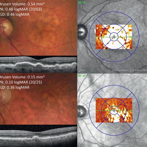 Image result for Oct Line Scan