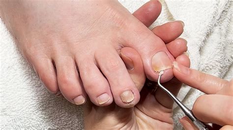 Image result for Clean Toenails
