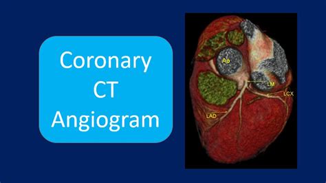 Image result for Normal Coronary CT Angiogram