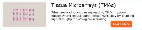 Image result for Tissue Microarray Multiplex IHC NCR