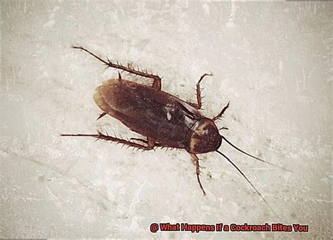 Image result for Cockroach Bites On Humans