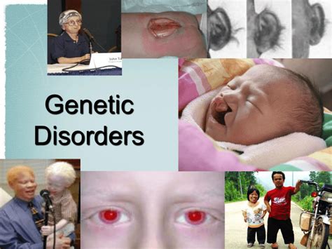 Image result for Genetic Problems