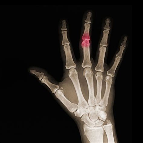 Image result for Image of Normal Hand Forgery