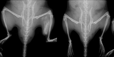 Image result for Types of Abnormal Bone Formation