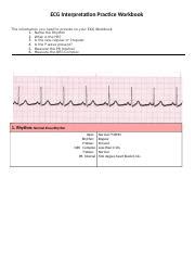 Image result for ECG Reading Practice