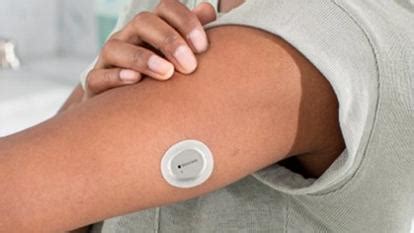 Image result for Dexcom Sensor Filament Structure