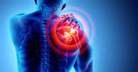 Image result for Rotator Cuff Repair Surgery