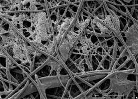 Image result for Bone Cells Function