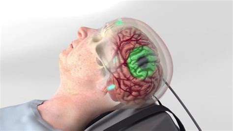 Image result for C4D Medical Modeling