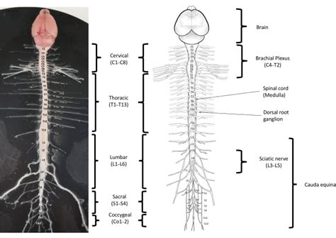Image result for Nervous System Dissection