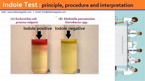 Image result for Indole Test Procedure