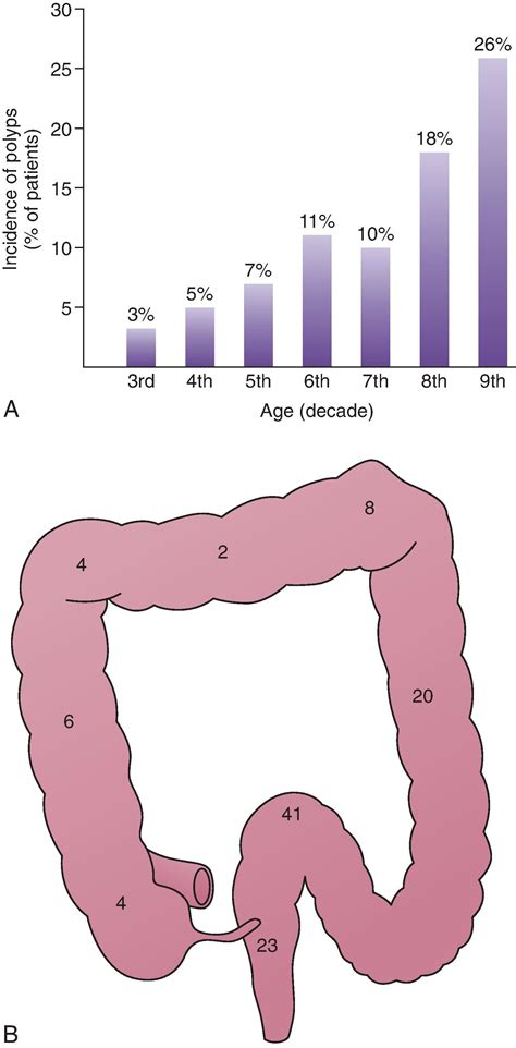 Image result for Colonoscopy Frequency Based On Polyps