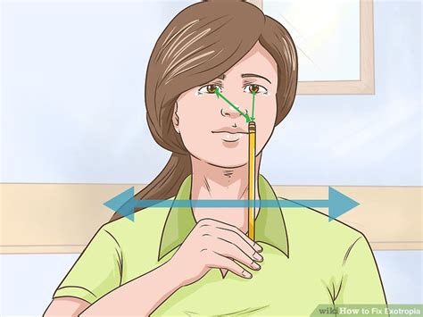 Image result for Exotropia and Computer