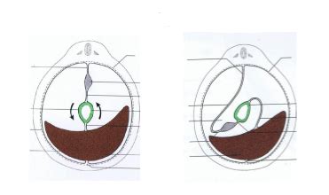 Image result for Invagination