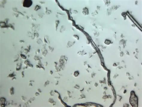 Image result for Pinworm Tape Test Procedure