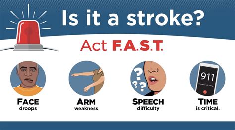 Image result for Fast Stroke