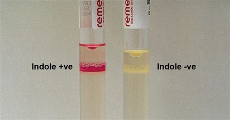 Image result for Indole Test Procedure