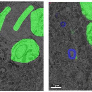 Image result for Tissue Classification Neural Network