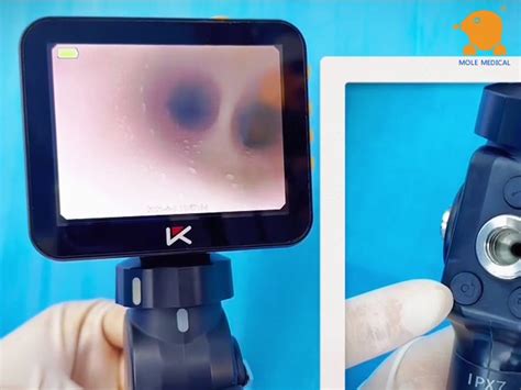 Image result for Intubation Steps