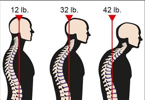 Image result for Forward Position