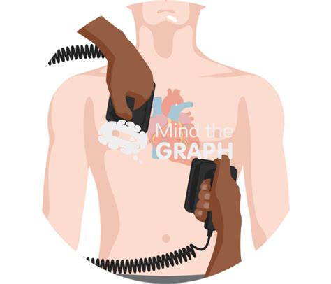 Image result for Defibrillation