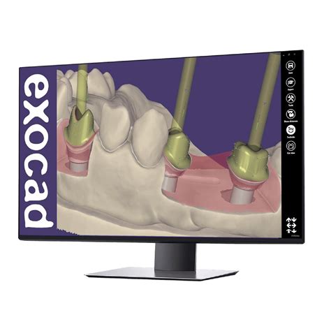 Image result for G Code From Exocad File