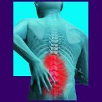 Image result for Mid-Back Muscle Spasm