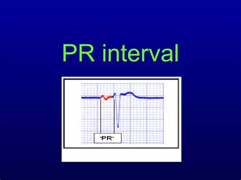 Image result for PR Interval ECG