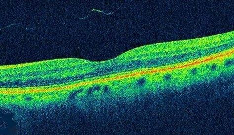 Image result for Oct Check