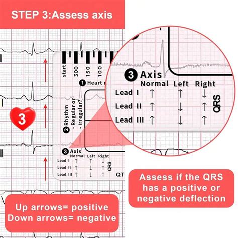 Image result for ECG Step by Step