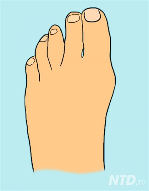 Image result for Different Types of Toes