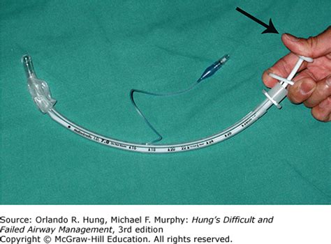 Image result for Non-Invasive Intubation