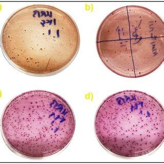 Image result for Total Count Method Microbiology