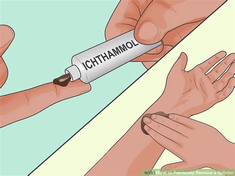 Image result for Drawing Ointment to Remove Splinter