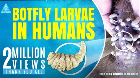 Image result for Human Botfly