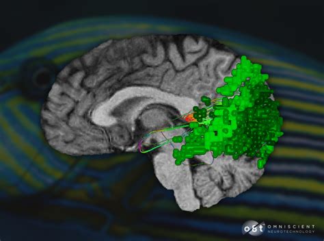 Image result for Visual System Cartoon