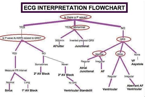 Image result for PR Interval ECG