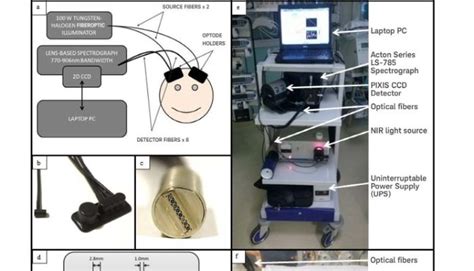 NIR Spectroscopy Aids in the Diagnosis of Neonatal Brain Injury