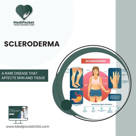 Image result for Scleroderma Skin